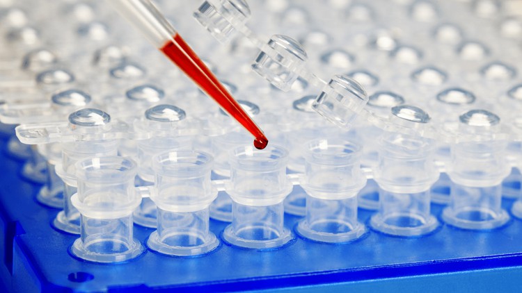 Learn DNA Primer Design for Polymerase Chain Reaction – CourseVania